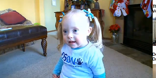 Usa, bimba down modella per una pubblicità di giocattoli