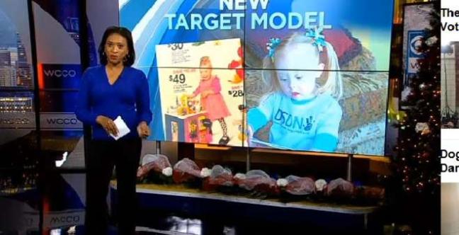 Usa, bimba down modella per una pubblicità di giocattoli